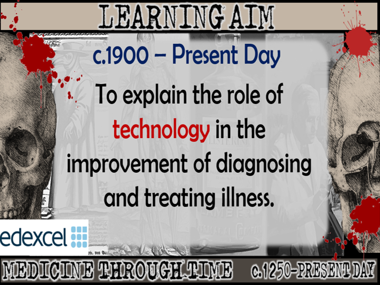 GCSE History Edexcel: Medicine in Britain UNIT 4 (1900-Present) Bundle ...