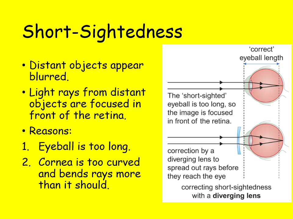 Edexcel SB2 The Eye Complete Lesson - GCSE Biology | Teaching Resources