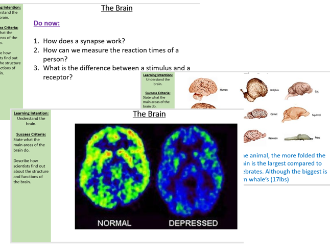 The Brain AQA B10.4 | Teaching Resources