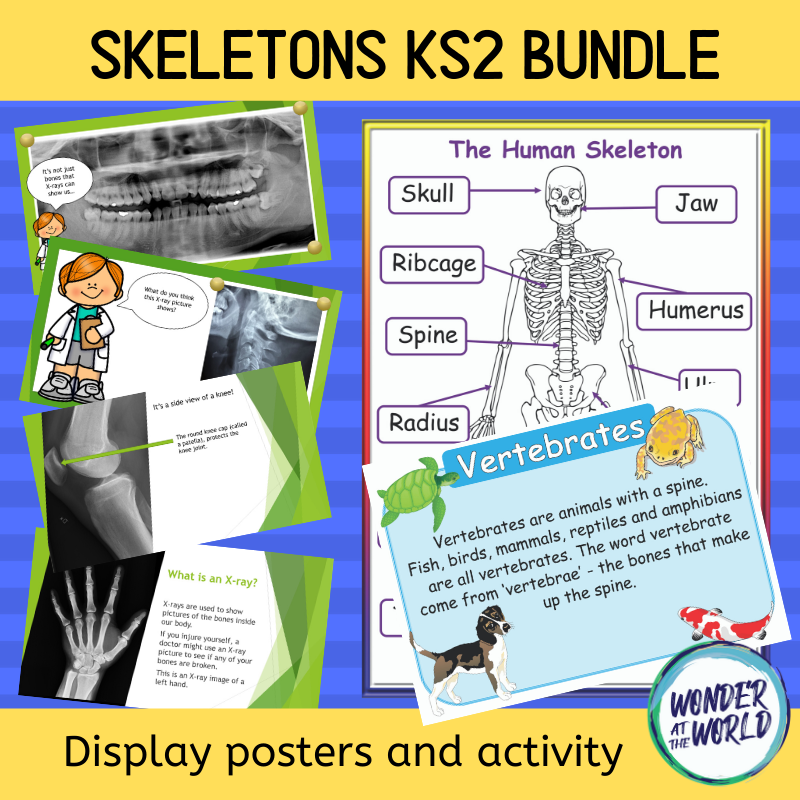 Skeletons display and X-ray activity | Teaching Resources