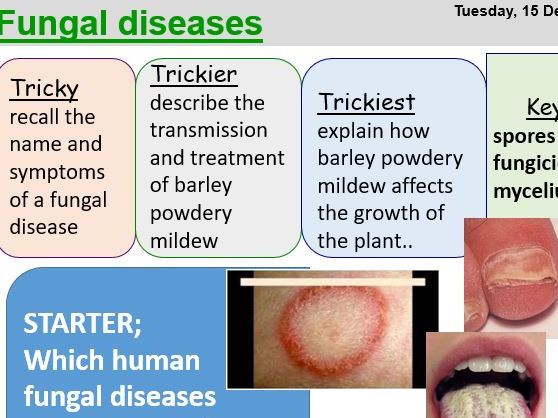 GCSE OCR (9-1) Fungal Disease | Teaching Resources