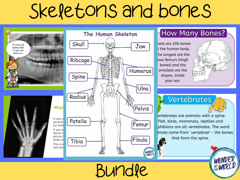 Skeletons display and X-ray activity | Teaching Resources