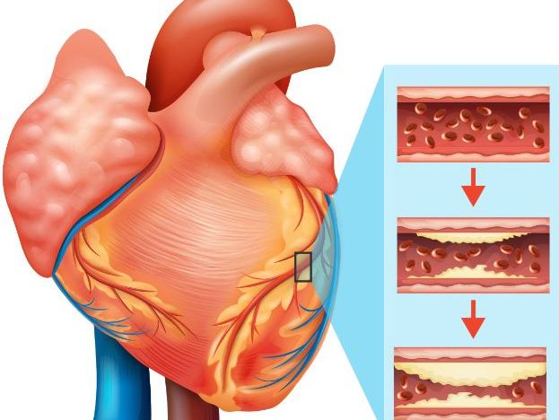 AQA New Spec Biology - Hereditary disease and heart disease 2020/2021 ...