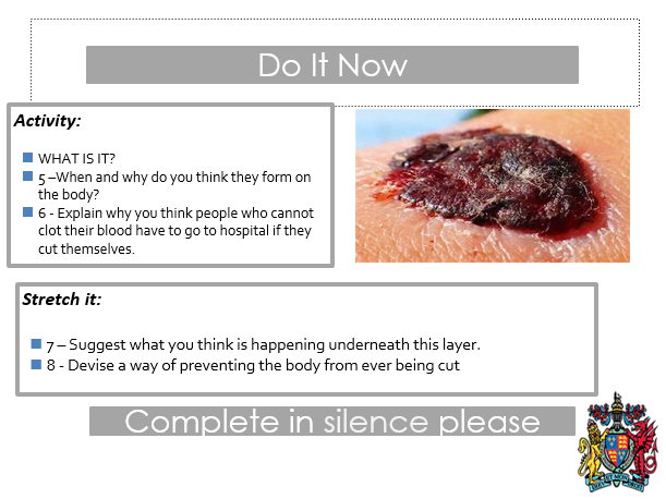 GCSE Topic 3 Infection Lesson 2 Preventing Disease Full Lesson ...