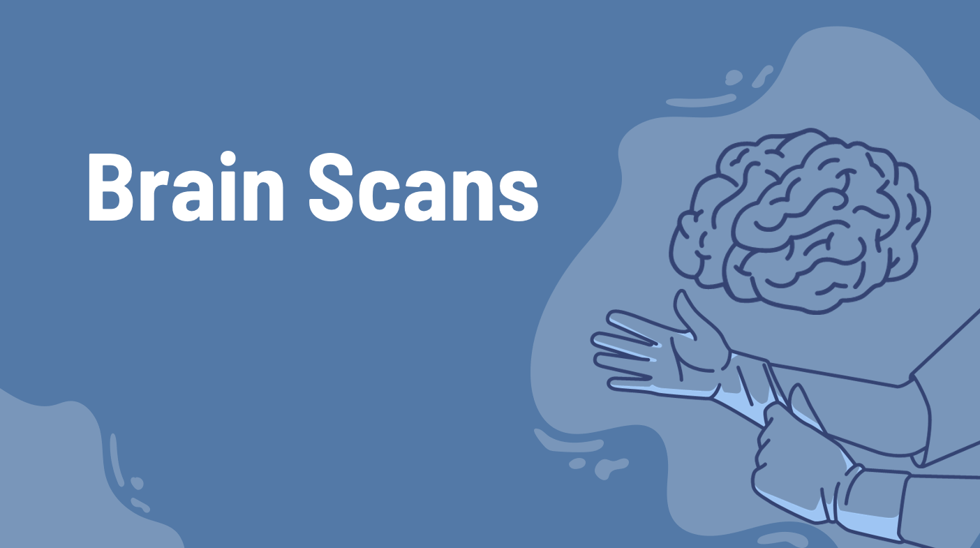 Brain Scans - Psychology A-Level | Teaching Resources